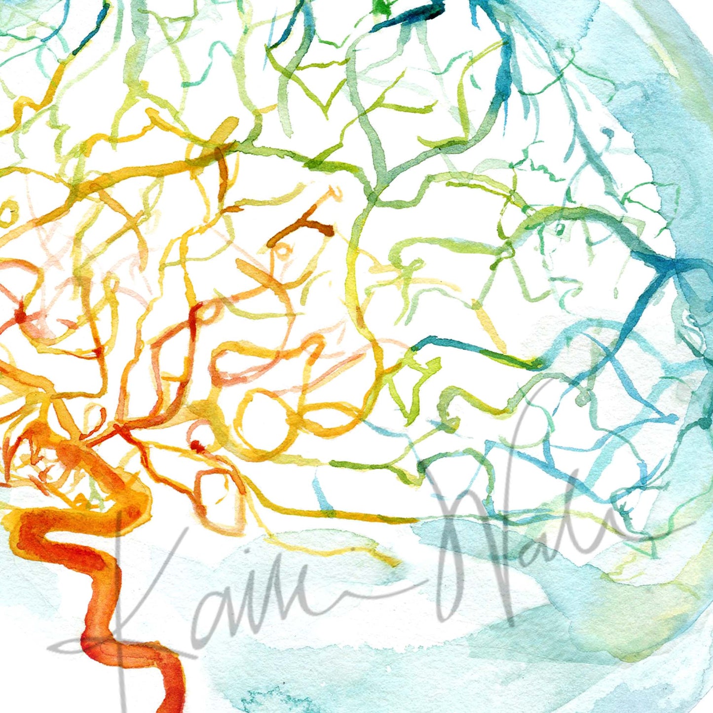 Rainbow Cerebral Angiography Watercolor Print – Lyon Road Art