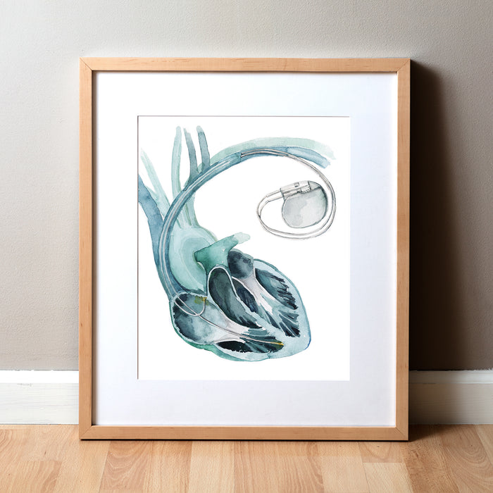 Anatomical Heart and Pacemaker Watercolor Art Print – Lyon Road Art