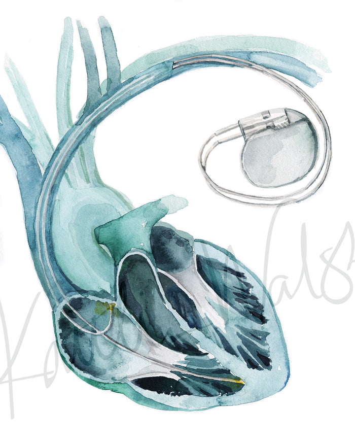 Anatomical Heart and Pacemaker Watercolor Art Print – Lyon Road Art