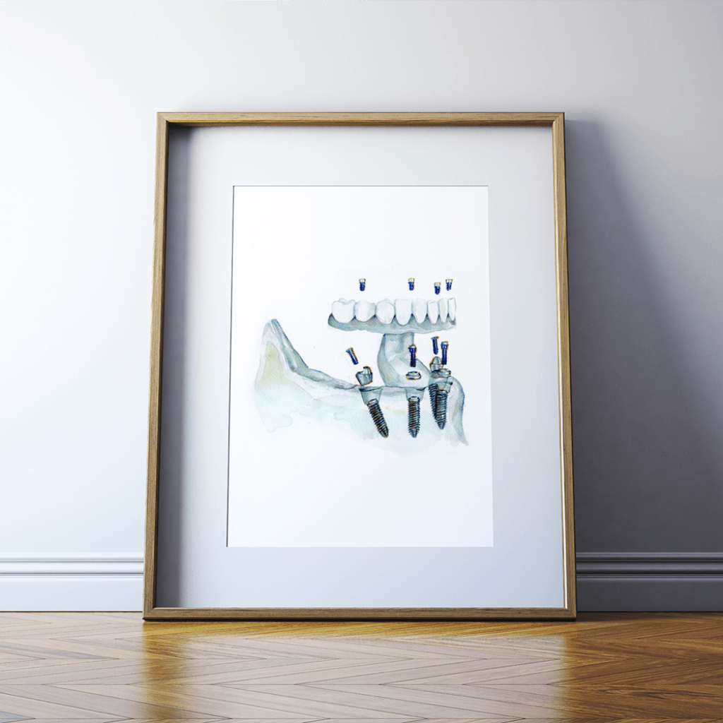 All On Four Watercolor Print | Dental Art – Lyon Road Art